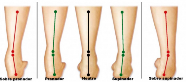 Pronador o Supinador y lesiones asociadas